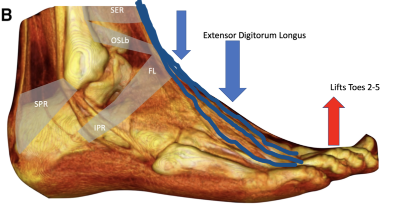 Extensor Digitorum Longus: Anatomy, Pain and Exercises - Dr. Justin Dean