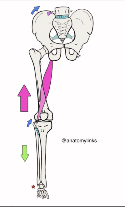 High Ankle Sprain: Sprained Ankle (Syndesmotic) - Dr. Justin Dean