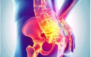 Ischial bursitis: Ischiogluteal pain - Dr. Justin Dean